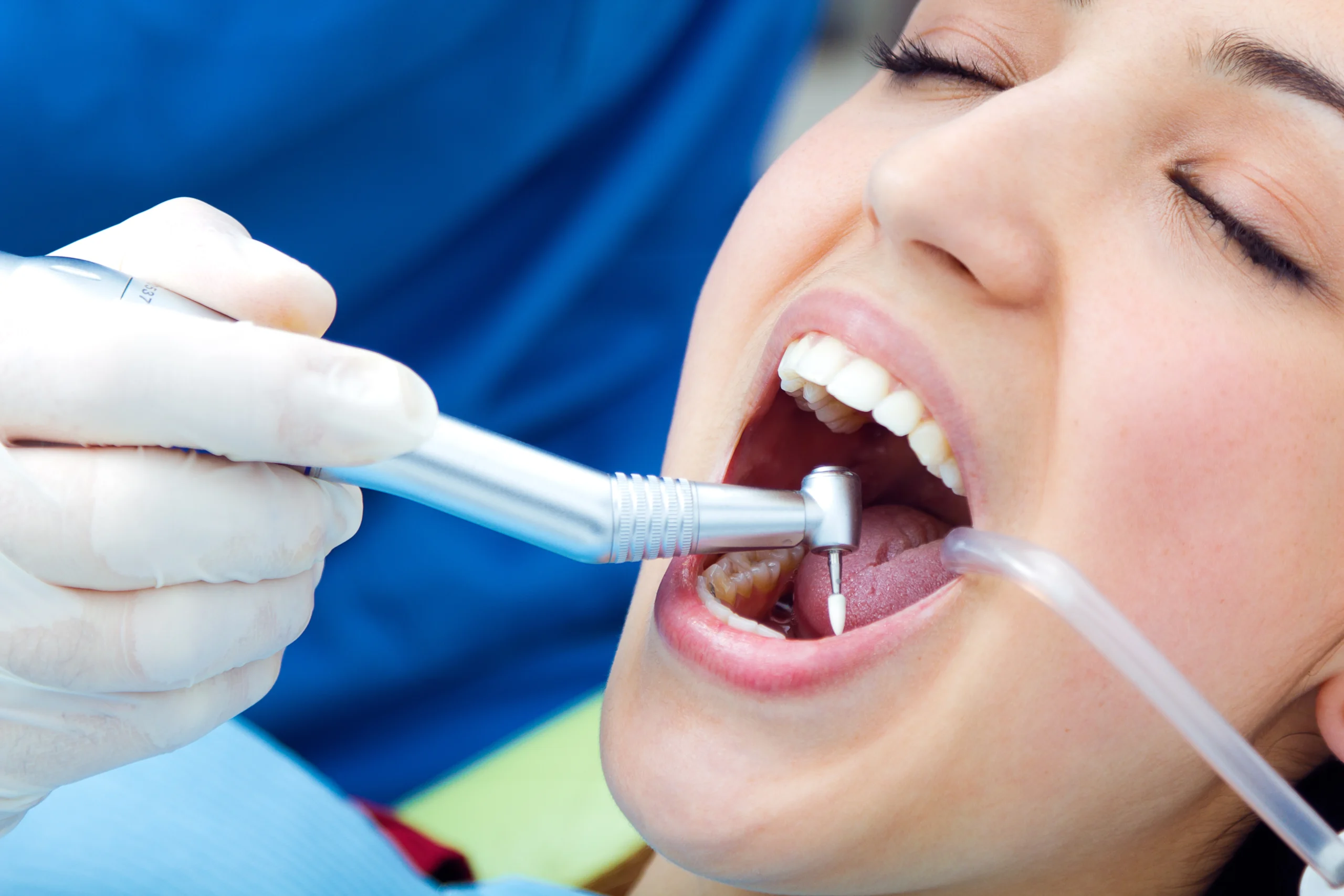 Dental Cleaning in Abu Dhabi | Gentle Teeth Cleaning